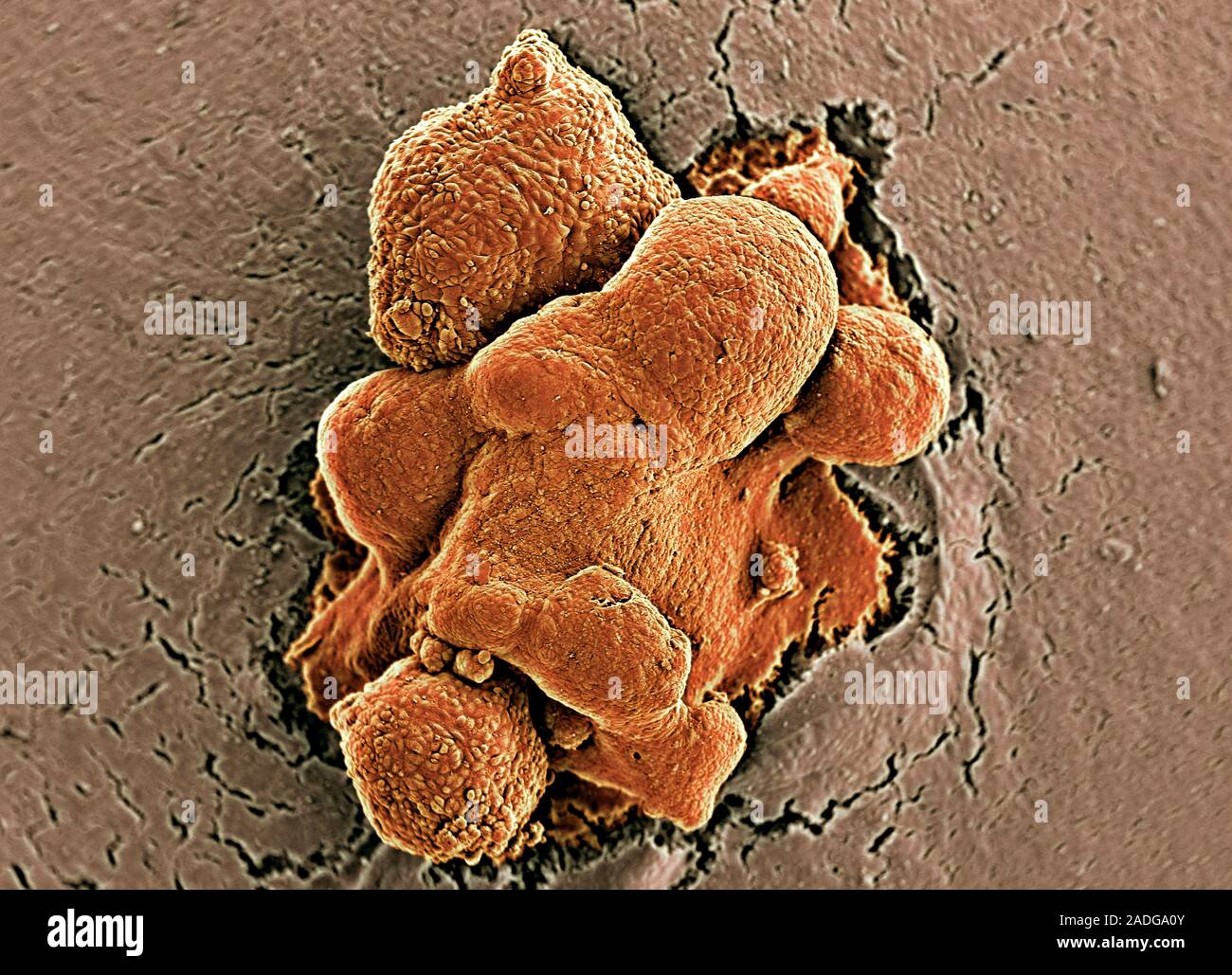 Stem cells. Coloured scanning electron micrograph (SEM) of many human ...