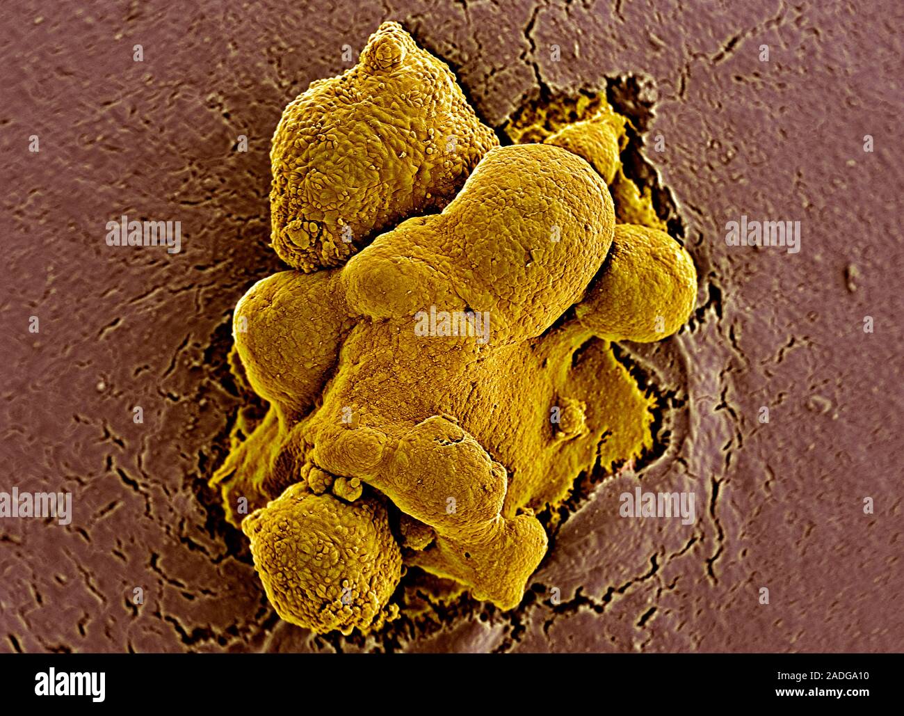 Stem cells. Coloured scanning electron micrograph (SEM) of many human ...