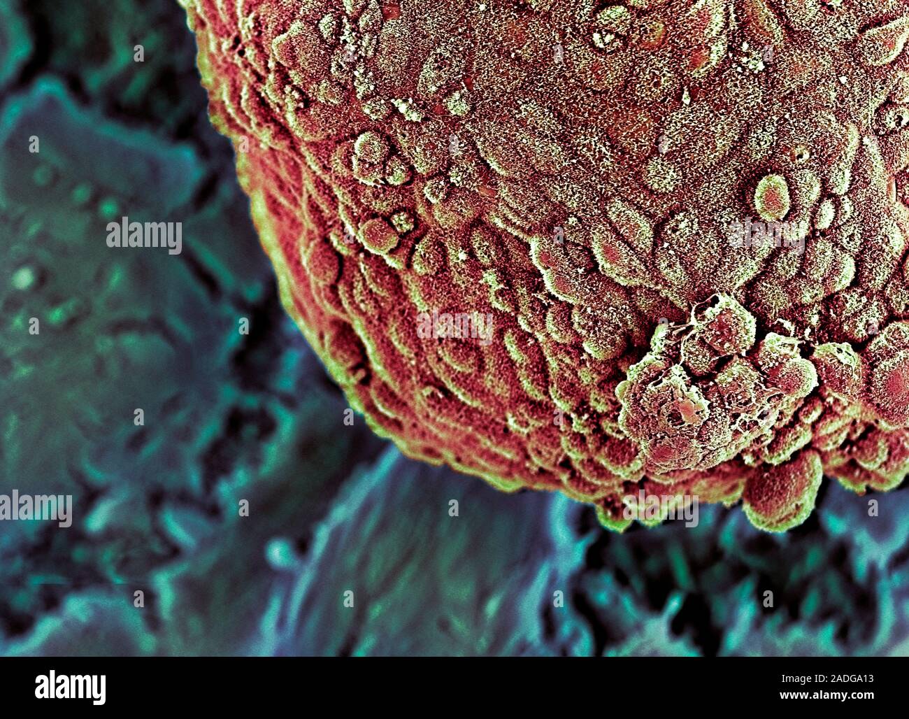 Stem cells. Coloured scanning electron micrograph (SEM) of part of a ...