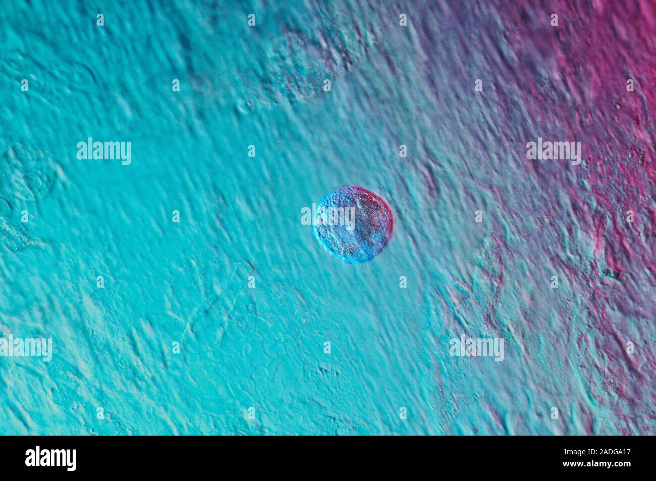 Stem cell. Coloured light micrograph of a human embryonic stem cell ...