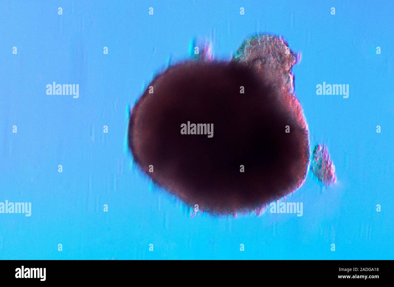 Specialising embryoid bodies, coloured light micrograph. These cells ...