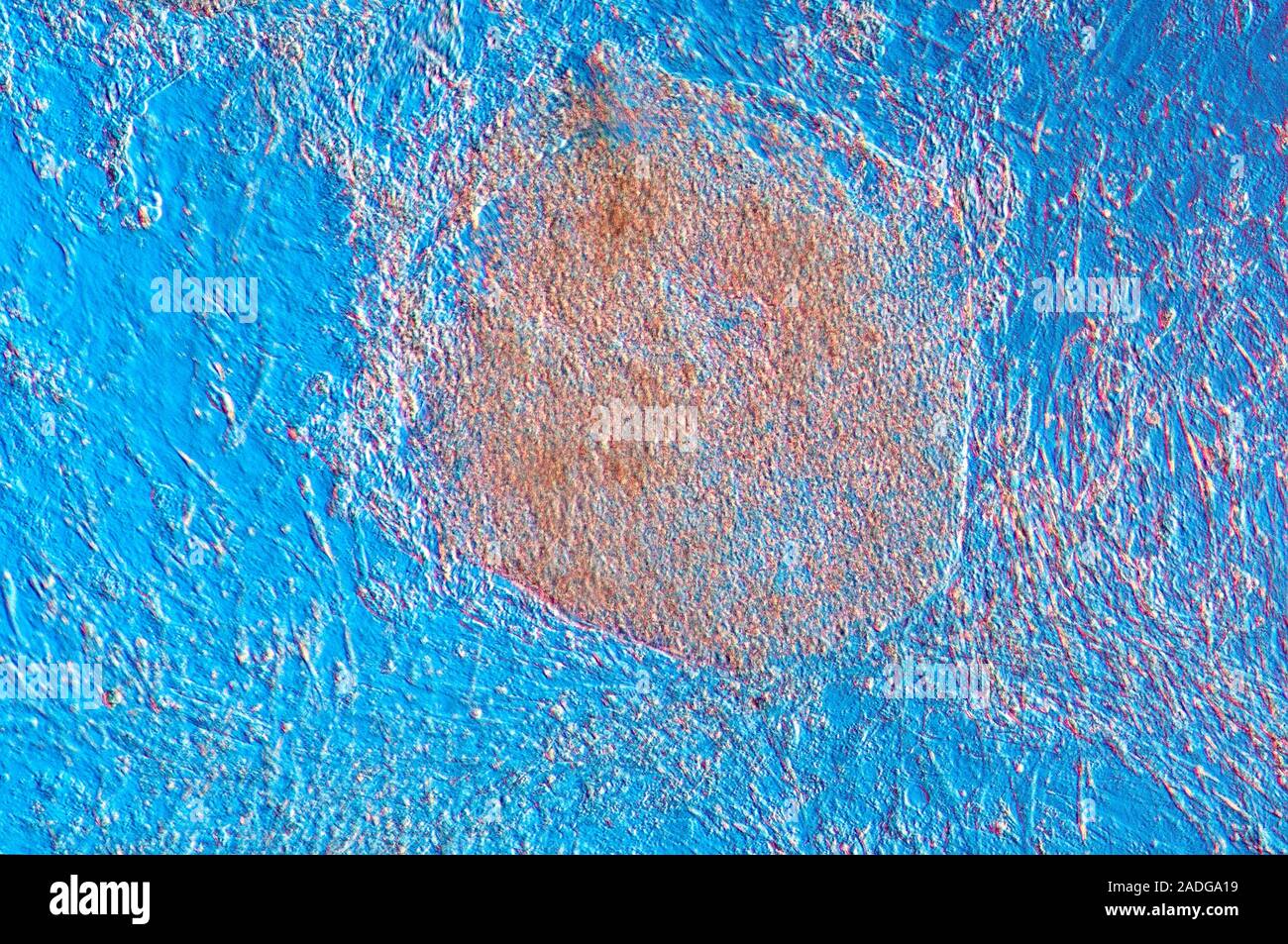 Embryoid bodies, coloured light micrograph. Embryoid bodies (EBs) are ...