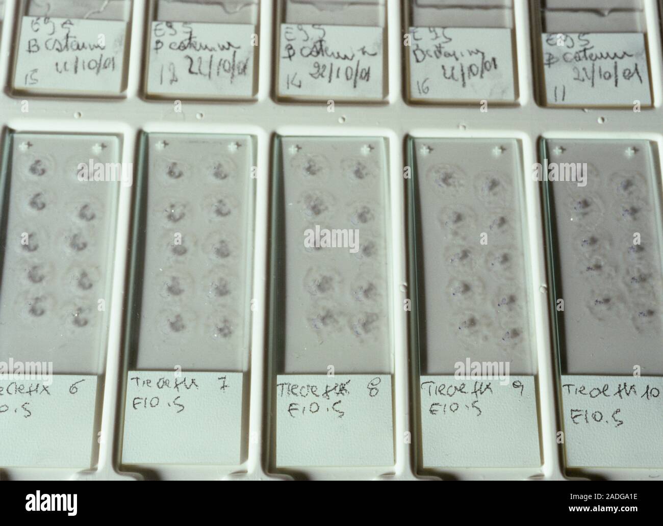 Stem cells. Stem cells on glass slides in a laboratory. Stem cells are ...
