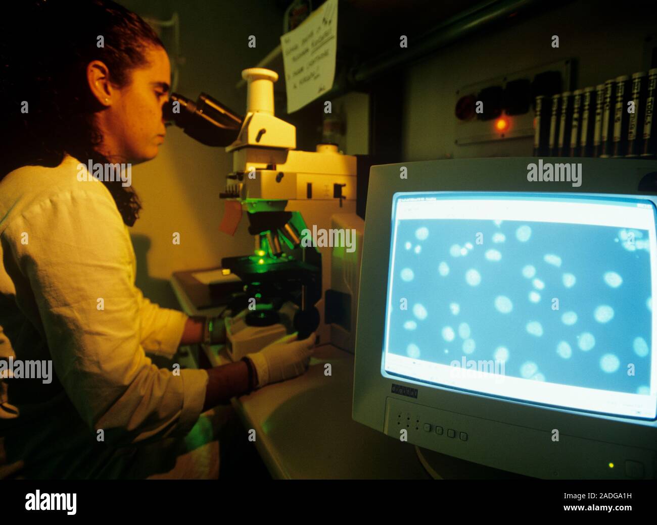 Stem cell research. Researcher studying stem cell nuclei (white on ...