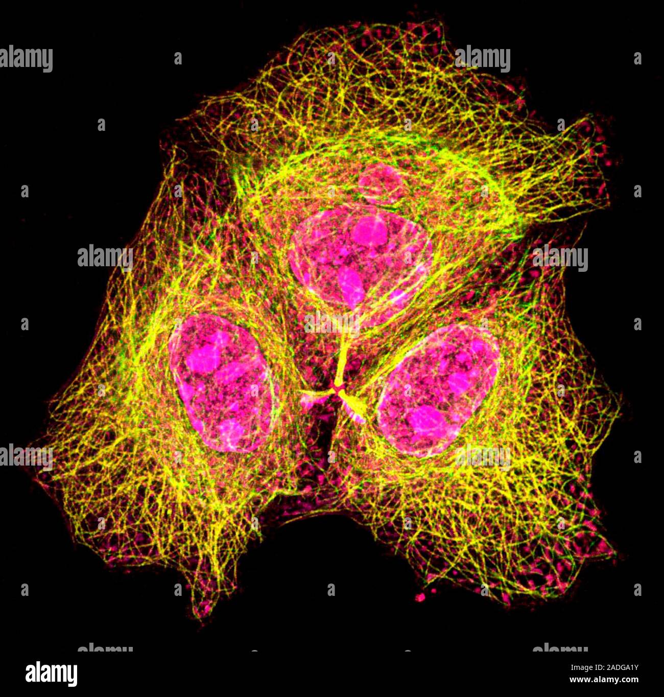 HeLa cells. Confocal light micrograph of three HeLa cells. The cells ...