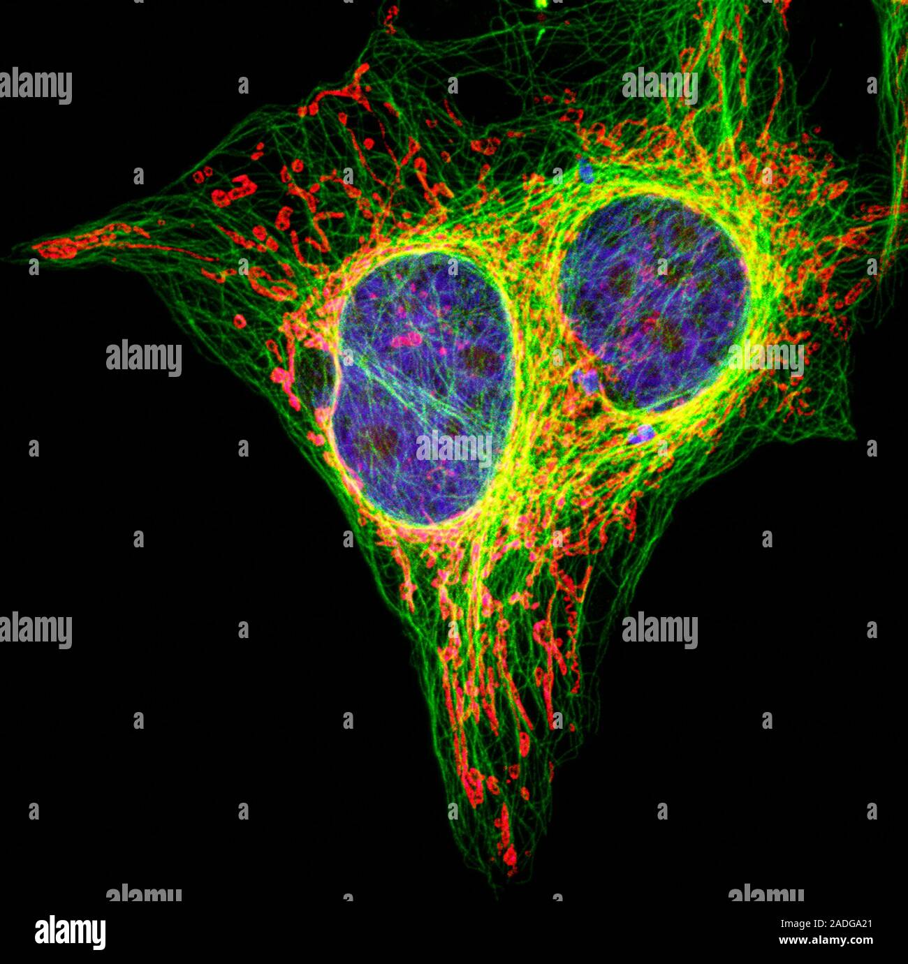 HeLa cells. Confocal light micrograph of two HeLa cells. The cell ...