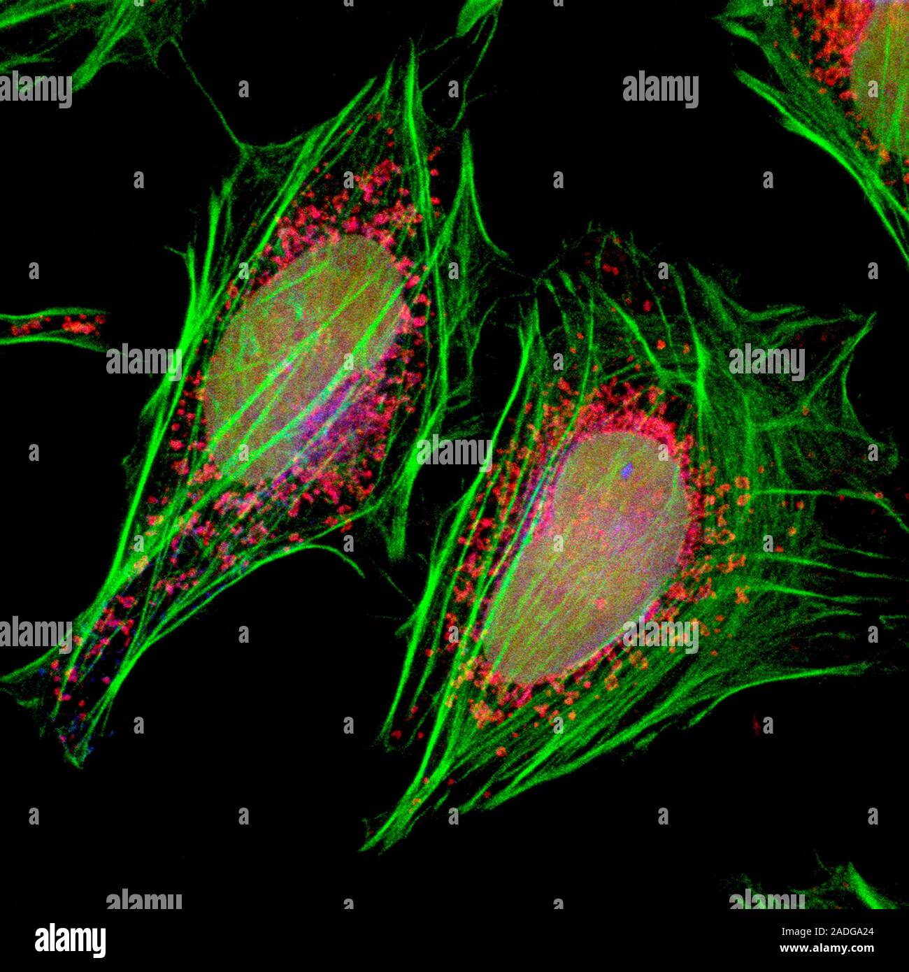 HeLa cells. Confocal light micrograph of two HeLa cells. The cell ...