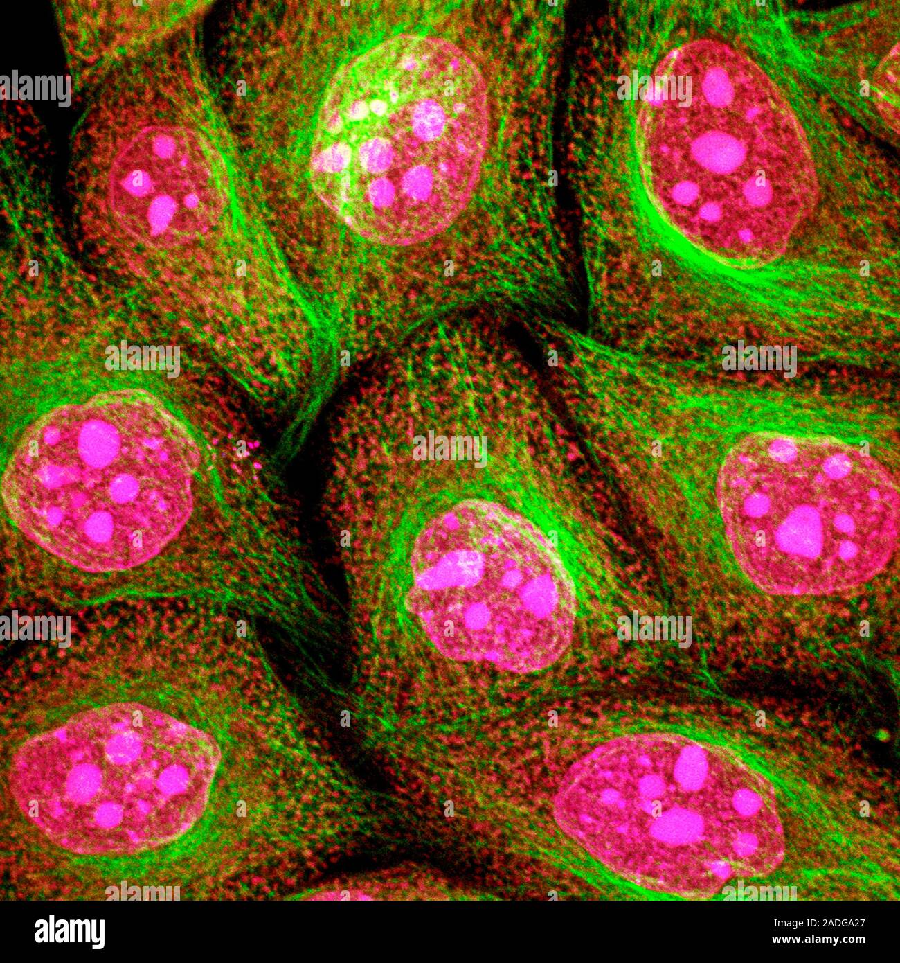 HeLa cells. Confocal light micrograph of HeLa cells. The cell nuclei ...