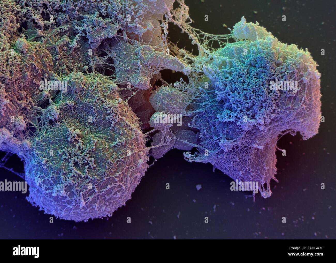 Stem cells. Coloured scanning electron micrograph (SEM) of a colony of ...