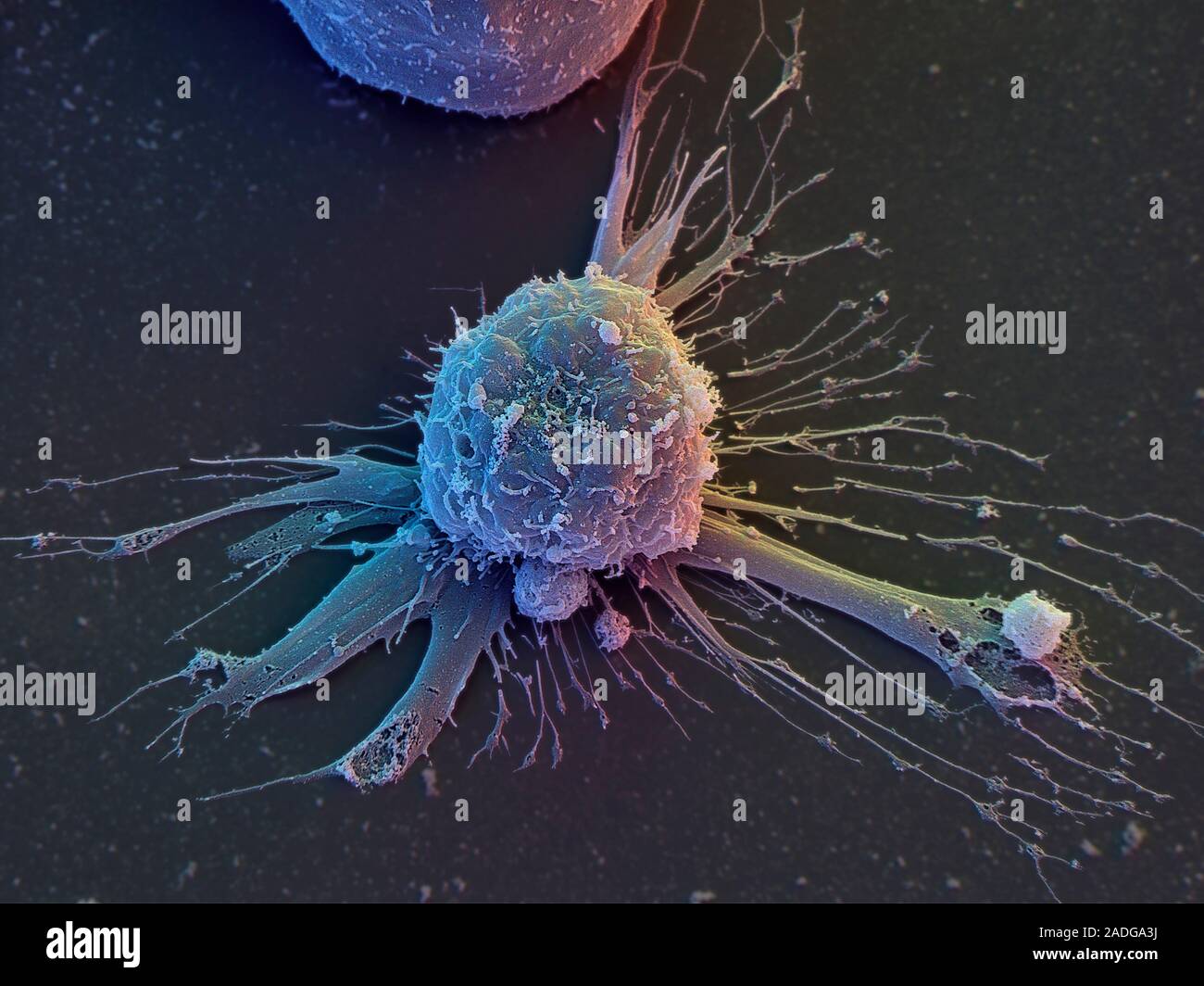 Stem cell. Coloured scanning electron micrograph (SEM) of a human ...