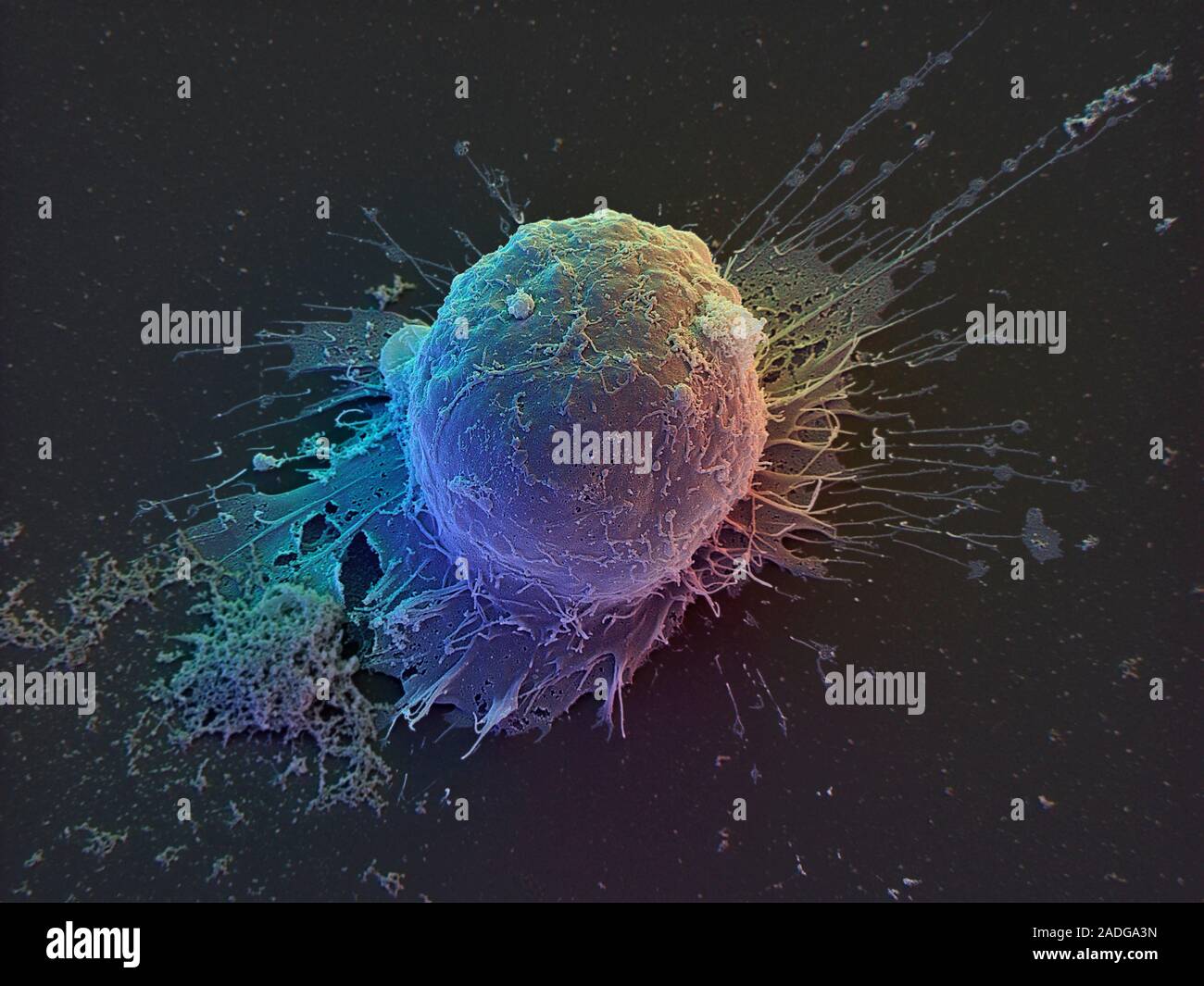 Stem cell. Coloured scanning electron micrograph (SEM) of a human ...
