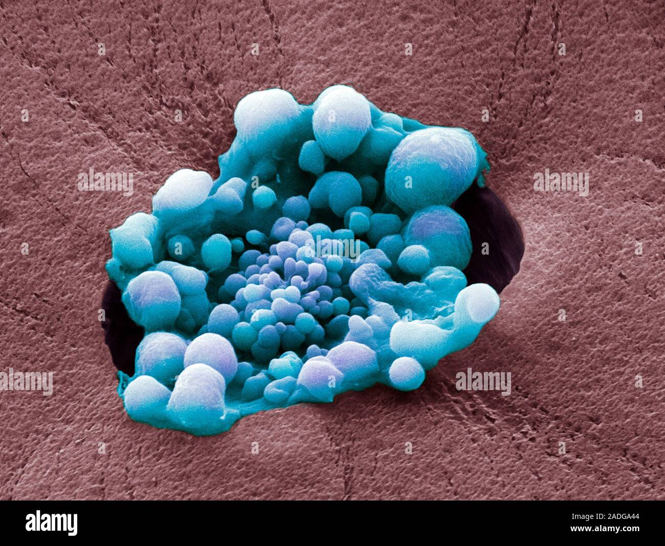 HeLa cells. Coloured scanning electron micrograph (SEM) of HeLa cells ...