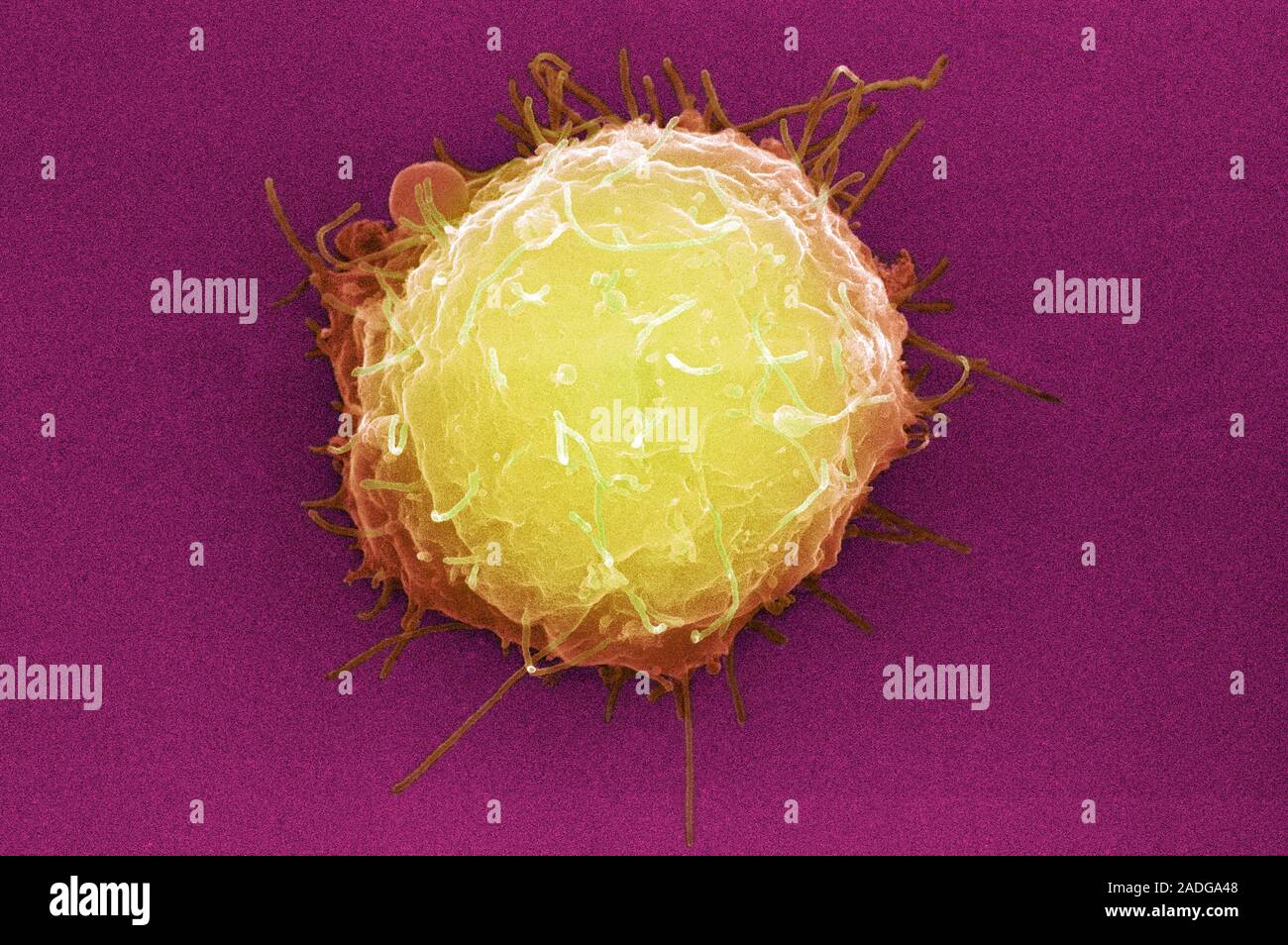 Embryonic stem cell. Coloured scanning electron micrograph (SEM) of a ...