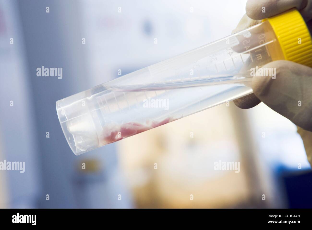 Muscle cell culture research. Researcher holding a sample of rat muscle ...