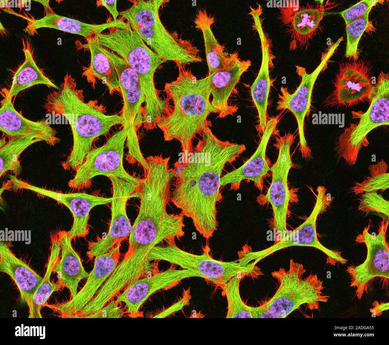 HeLa cells in culture, fluorescent light micrograph. HeLa cells are an ...