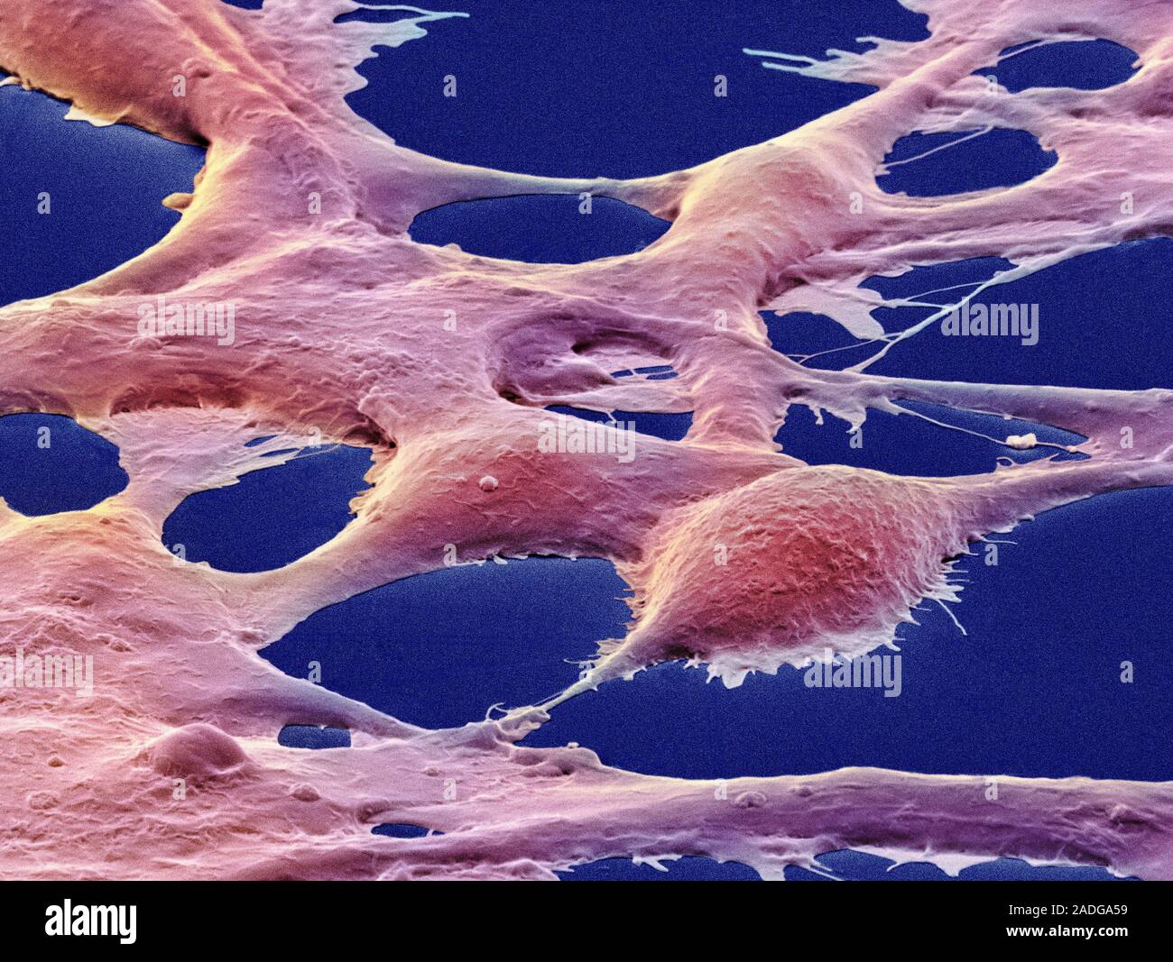 Human embryonic kidney cells. Coloured scanning electron micrograph ...
