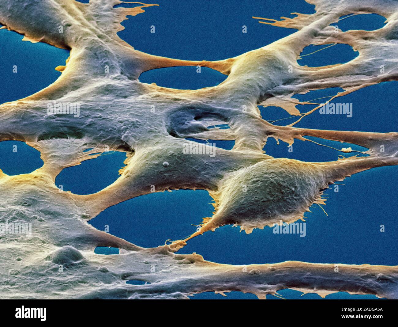 Human embryonic kidney cells. Coloured scanning electron micrograph ...