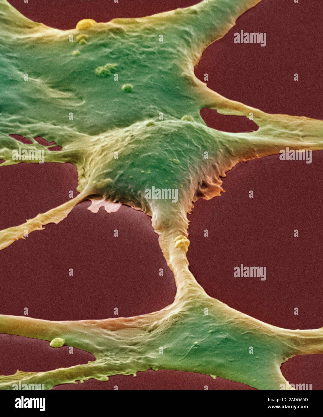 Human embryonic kidney cells. Coloured scanning electron micrograph ...