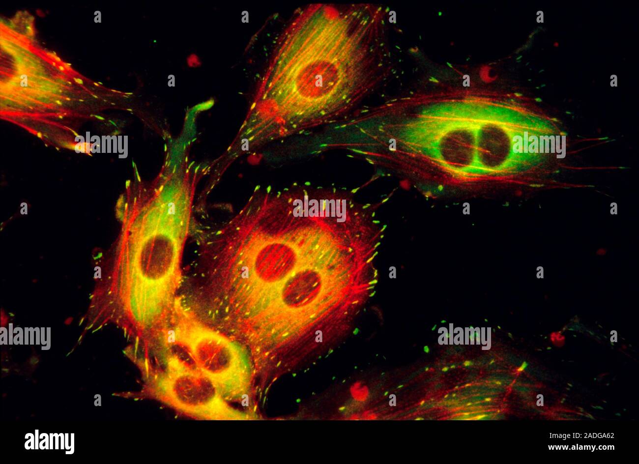 Cell structure. Light micrograph of cultured endothelial cells ...