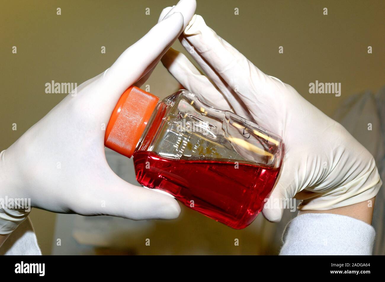 Stem cell research. Hands holding a culture flask of human embryonic ...