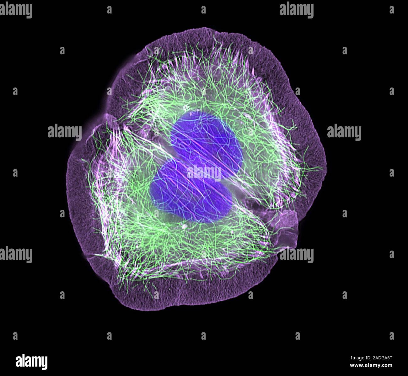 HaCaT cell. Immunofluorescence light micrograph of a HaCaT cell ...