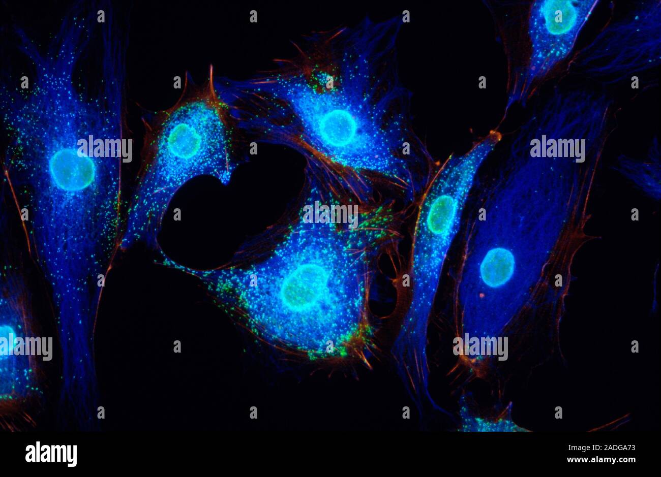 Human endothelial cells. Light micrograph of cultured human endothelial ...