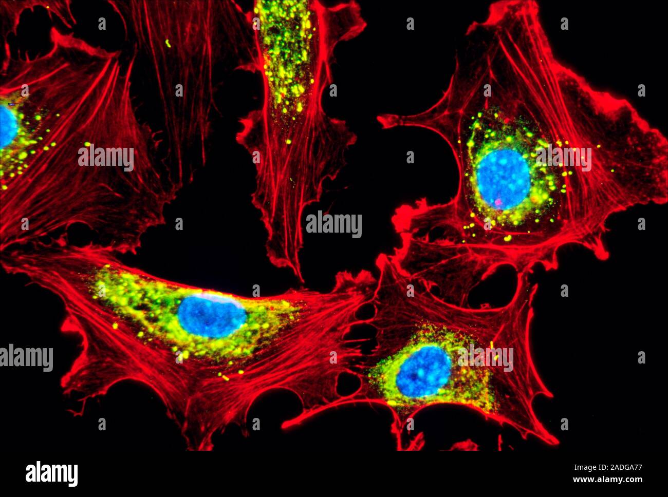 Human endothelial cells. Light micrograph of cultured human endothelial ...