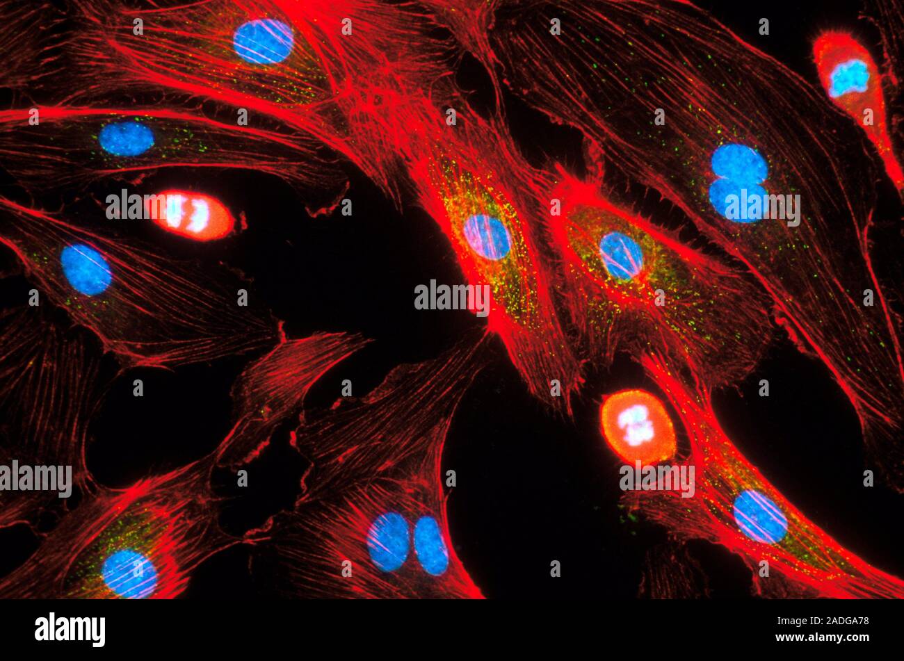 Human endothelial cells. Light micrograph of cultured human endothelial ...