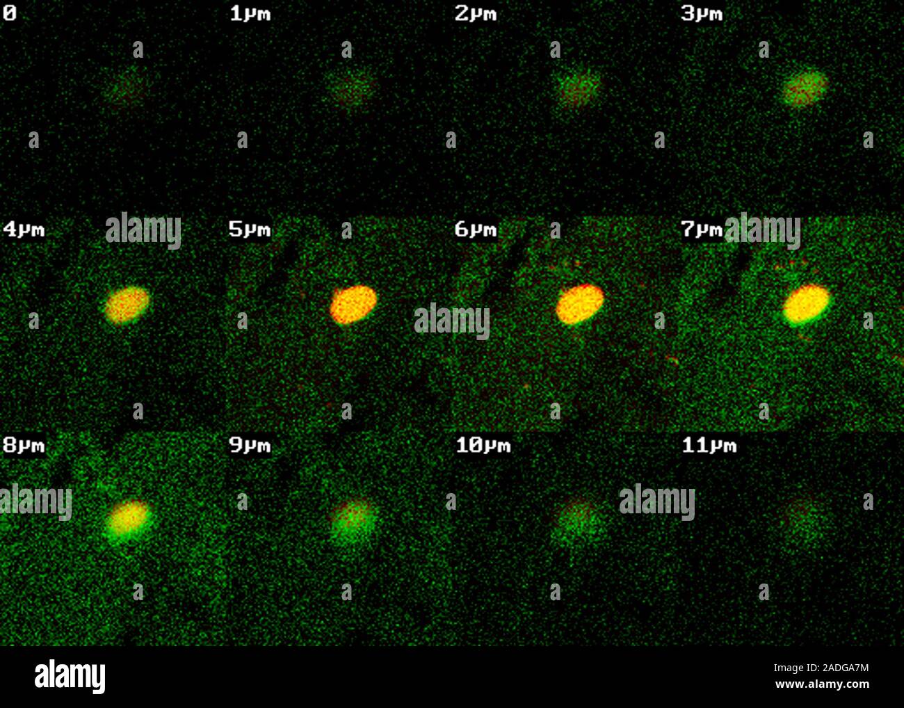 Monkey brains. Confocal light micrographs of sections through a monkey ...
