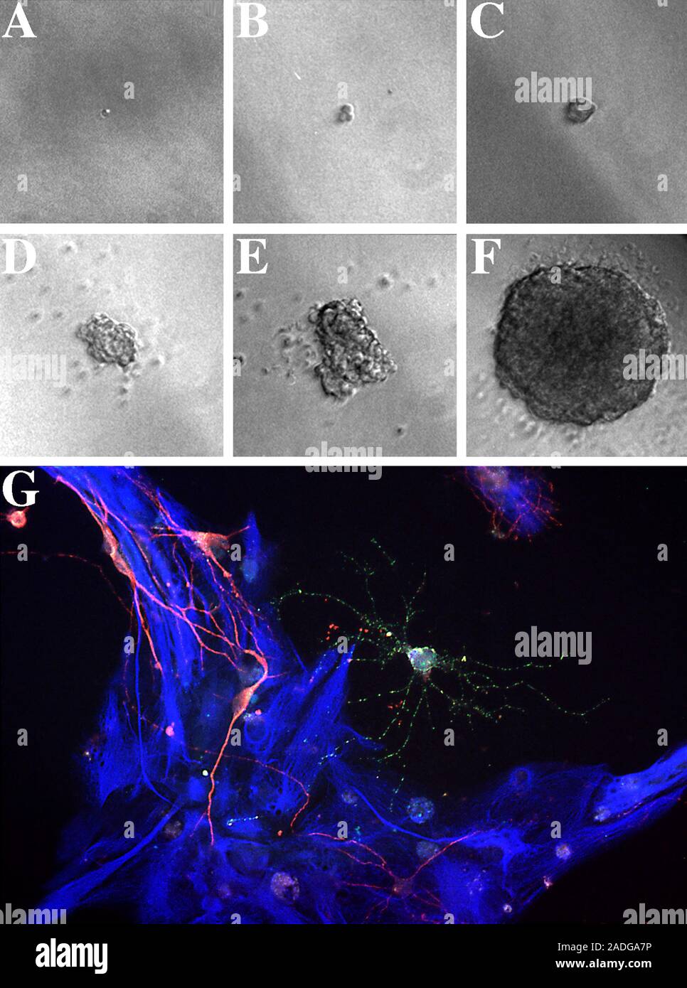 Brain cell differentiation. Light micrographs of the stages of maturing ...