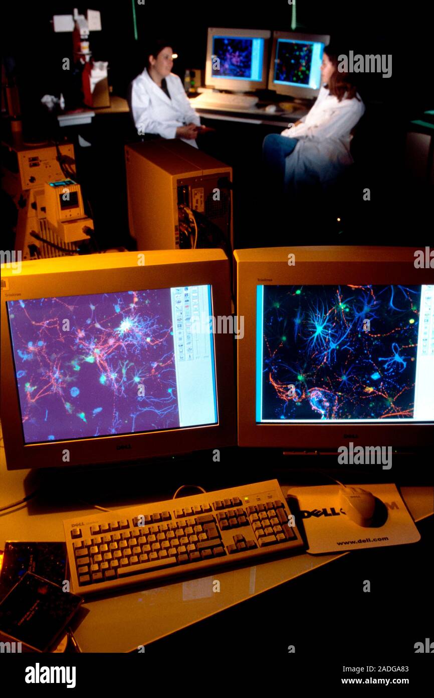Stem cell research. Computer displays showing light micrographs of stem ...
