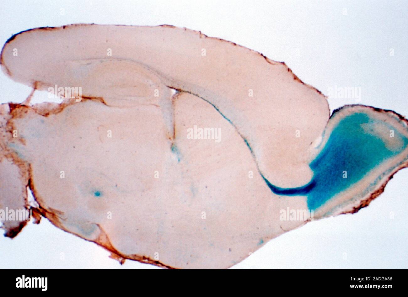 Chicken embryo brain. Histological sample of a chicken embryo brain ...