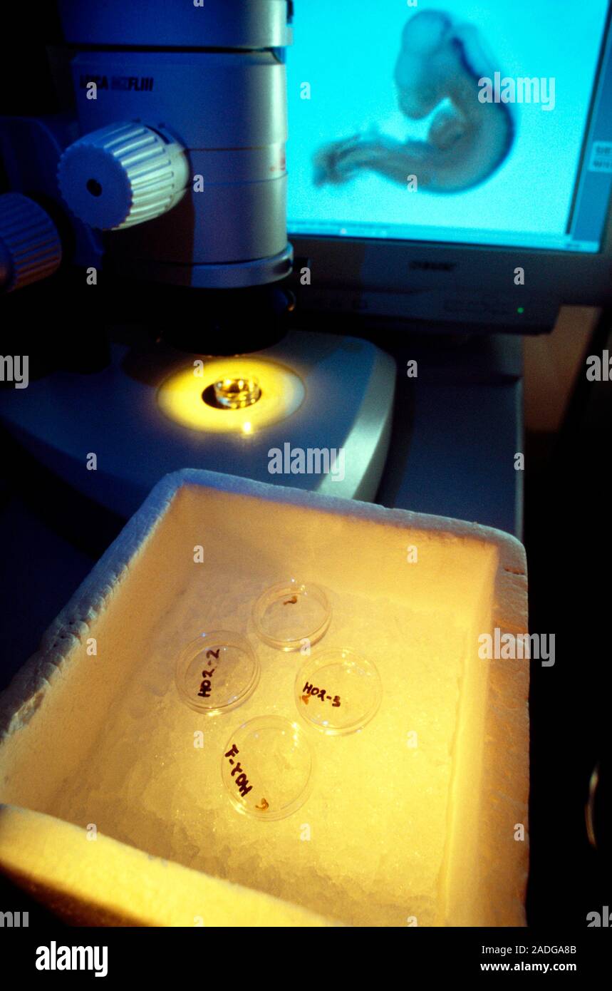 Stem cell research. Samples of stem cells (lower centre) obtained from ...
