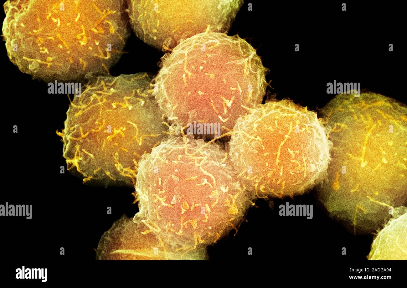 Stem cells, coloured scanning electron micrograph (SEM). Stem cells can ...