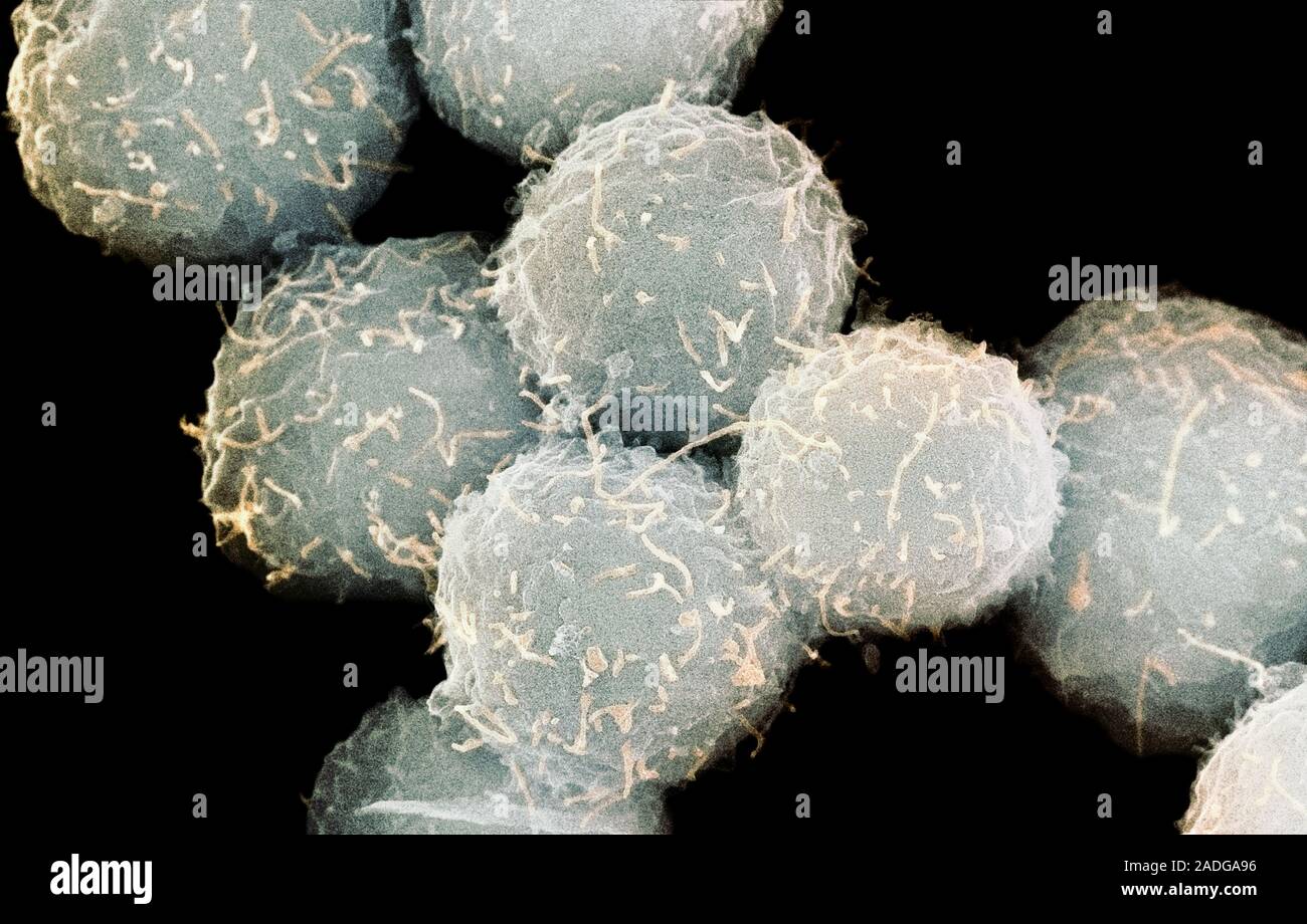 Stem cells, coloured scanning electron micrograph (SEM). Stem cells can ...