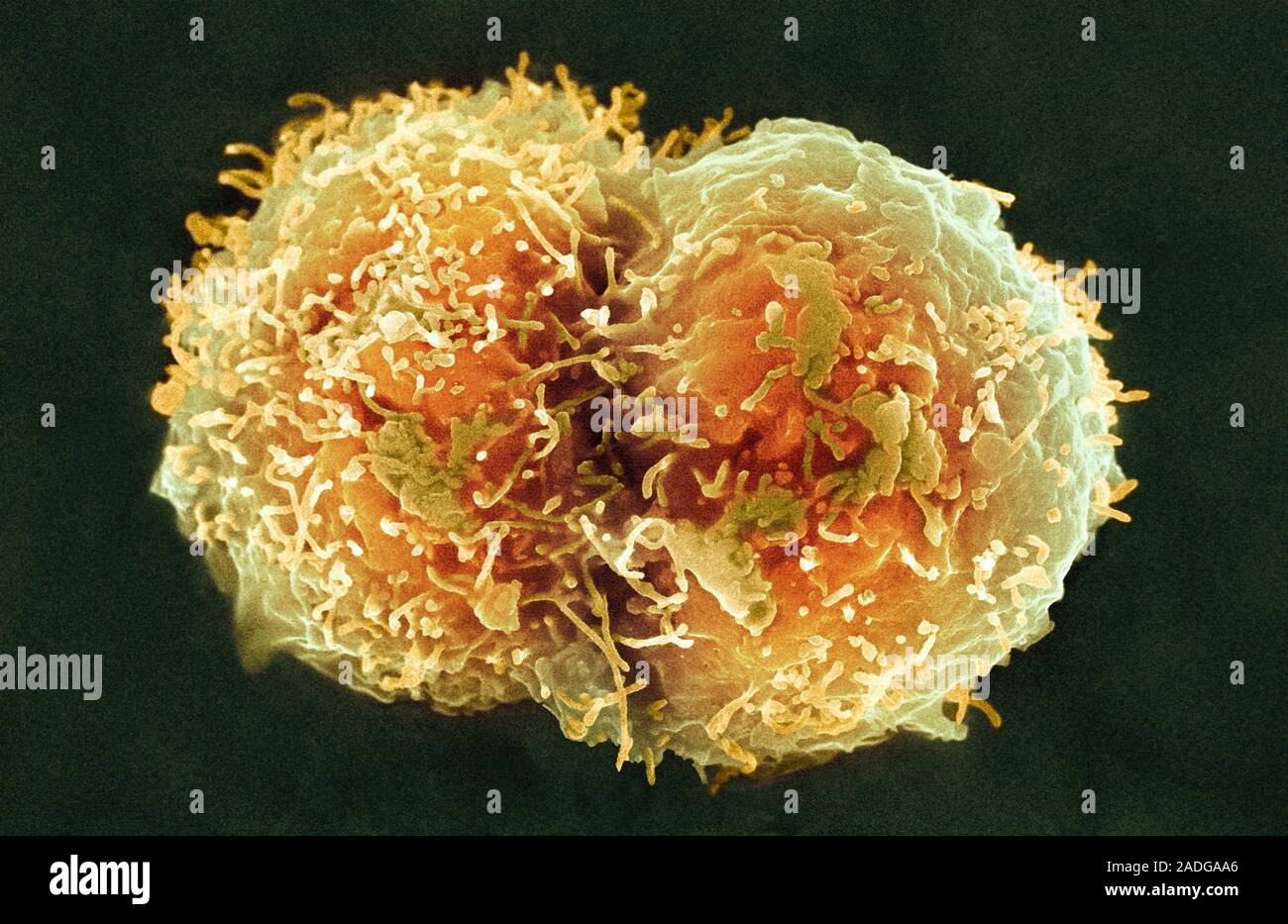 Stem cells, coloured scanning electron micrograph (SEM). Stem cells can ...