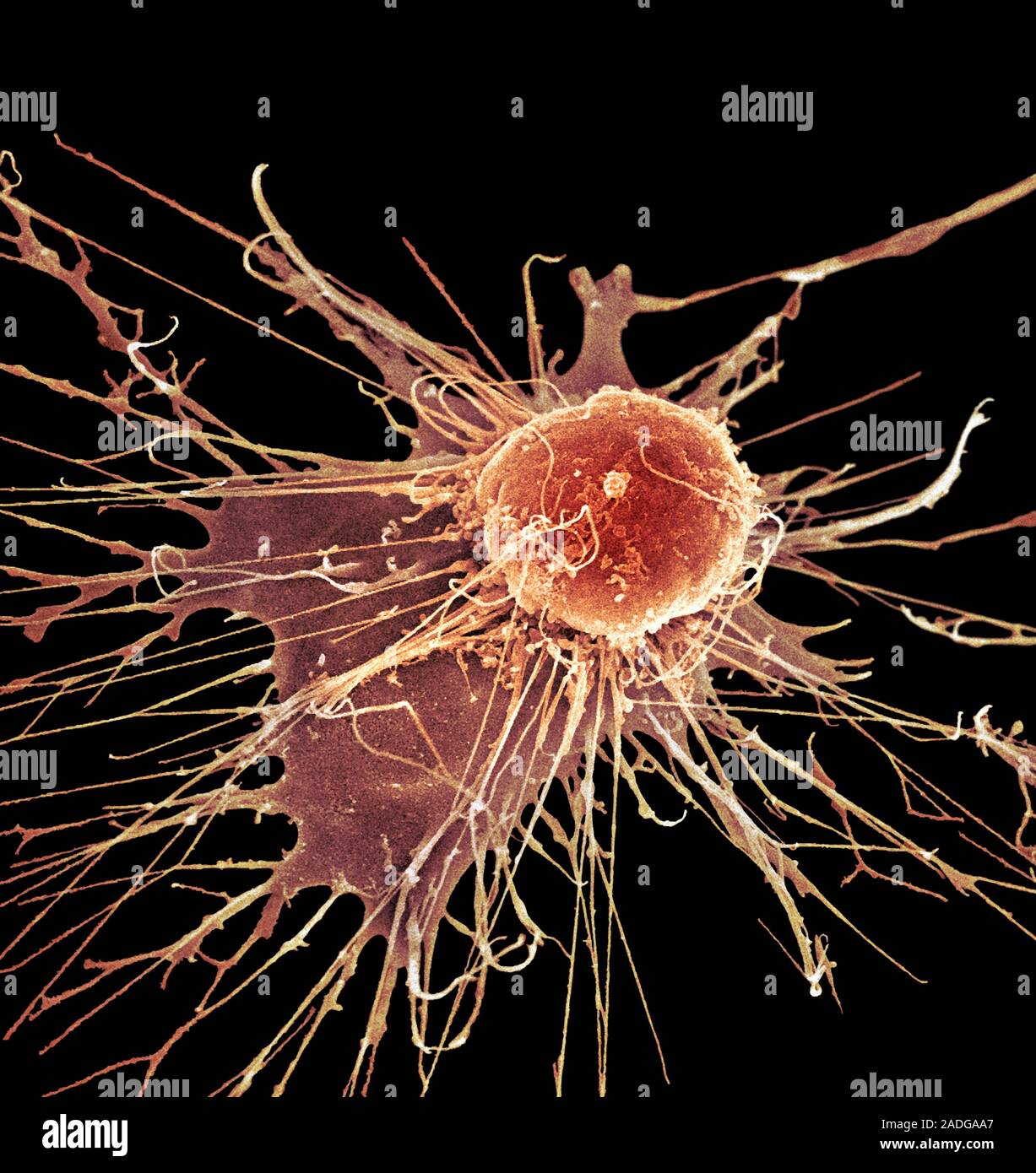 Stem cell, coloured scanning electron micrograph (SEM). Stem cells can ...