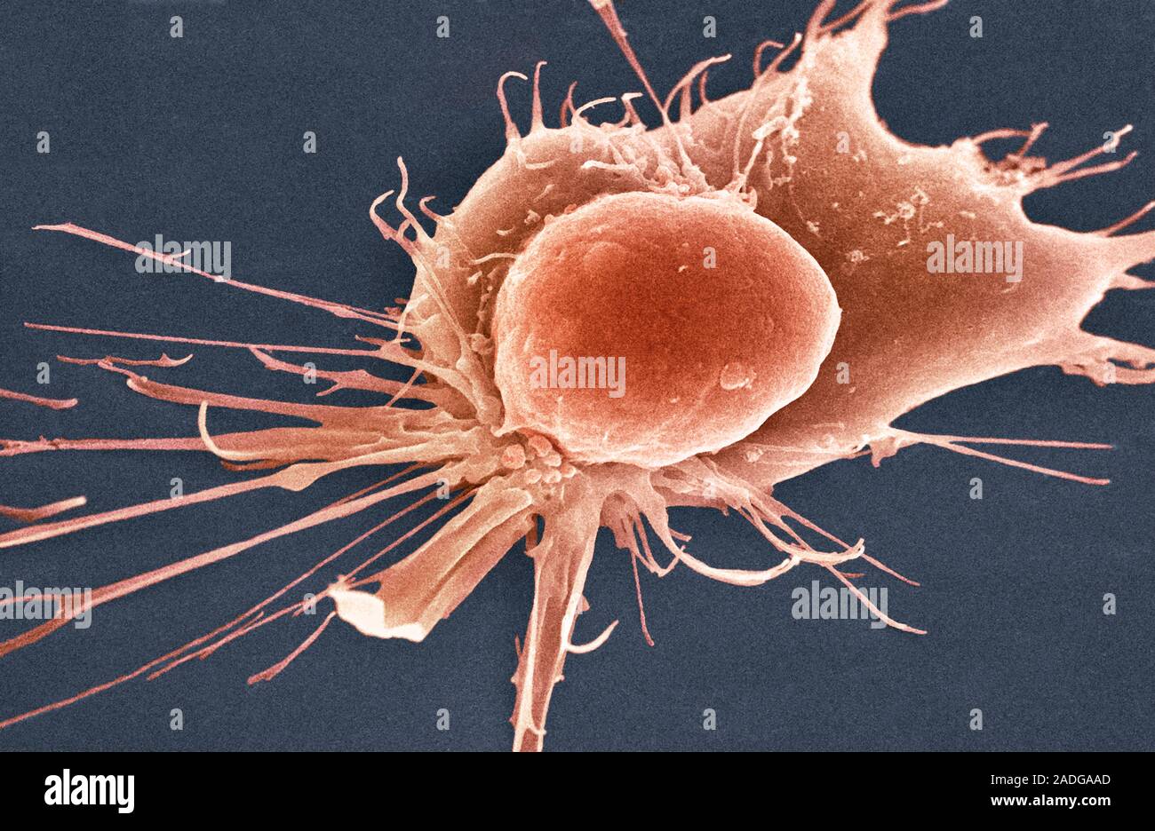 Stem cell, coloured scanning electron micrograph (SEM). Stem cells can ...