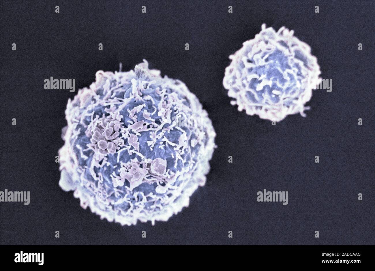 Stem cells, coloured scanning electron micrograph (SEM). Stem cells can differentiate into any ...
