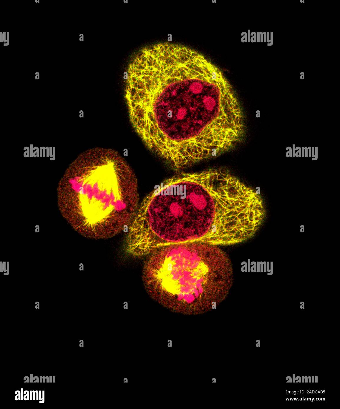 Mitosis of HeLa cells. Confocal light micrograph of HeLa cells during ...