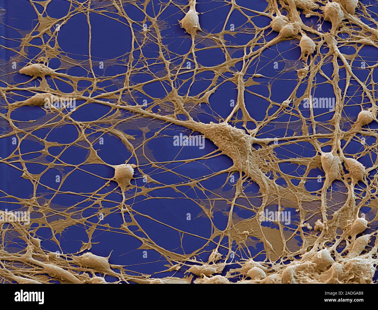 Human neural progenitor cells in a culture medium, coloured scanning ...