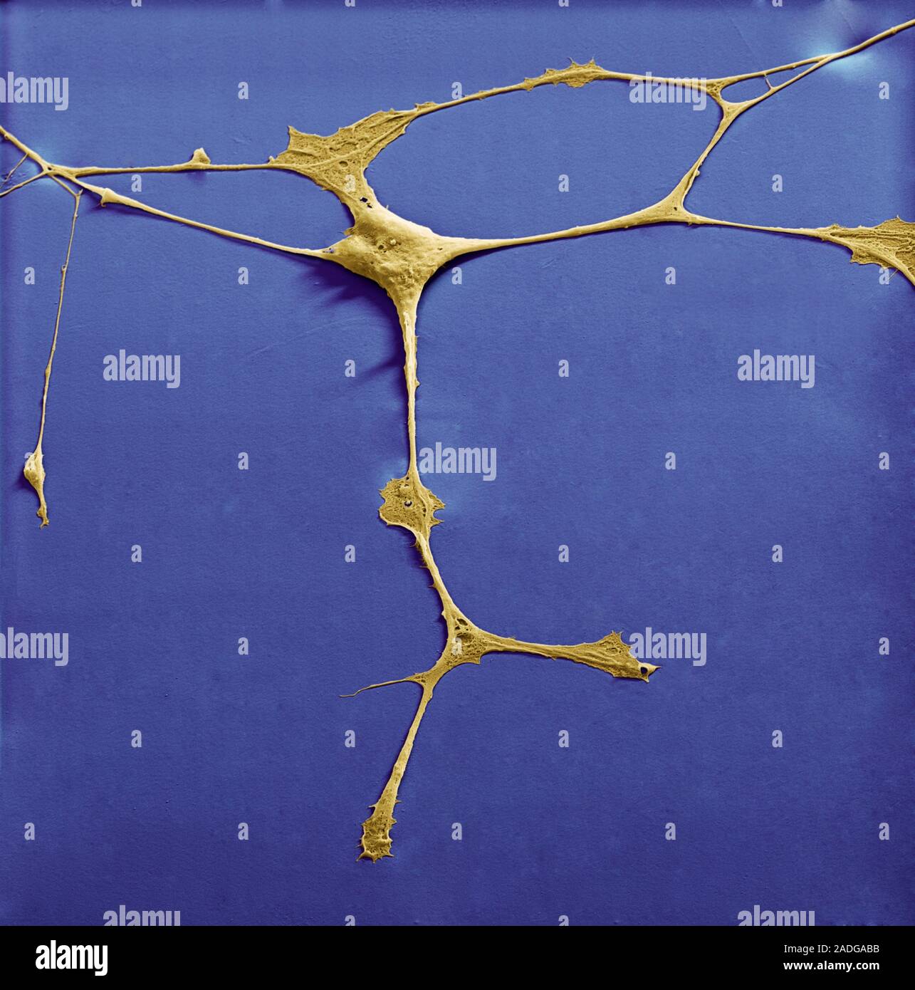 Human neural progenitor cells in a culture medium, coloured scanning ...