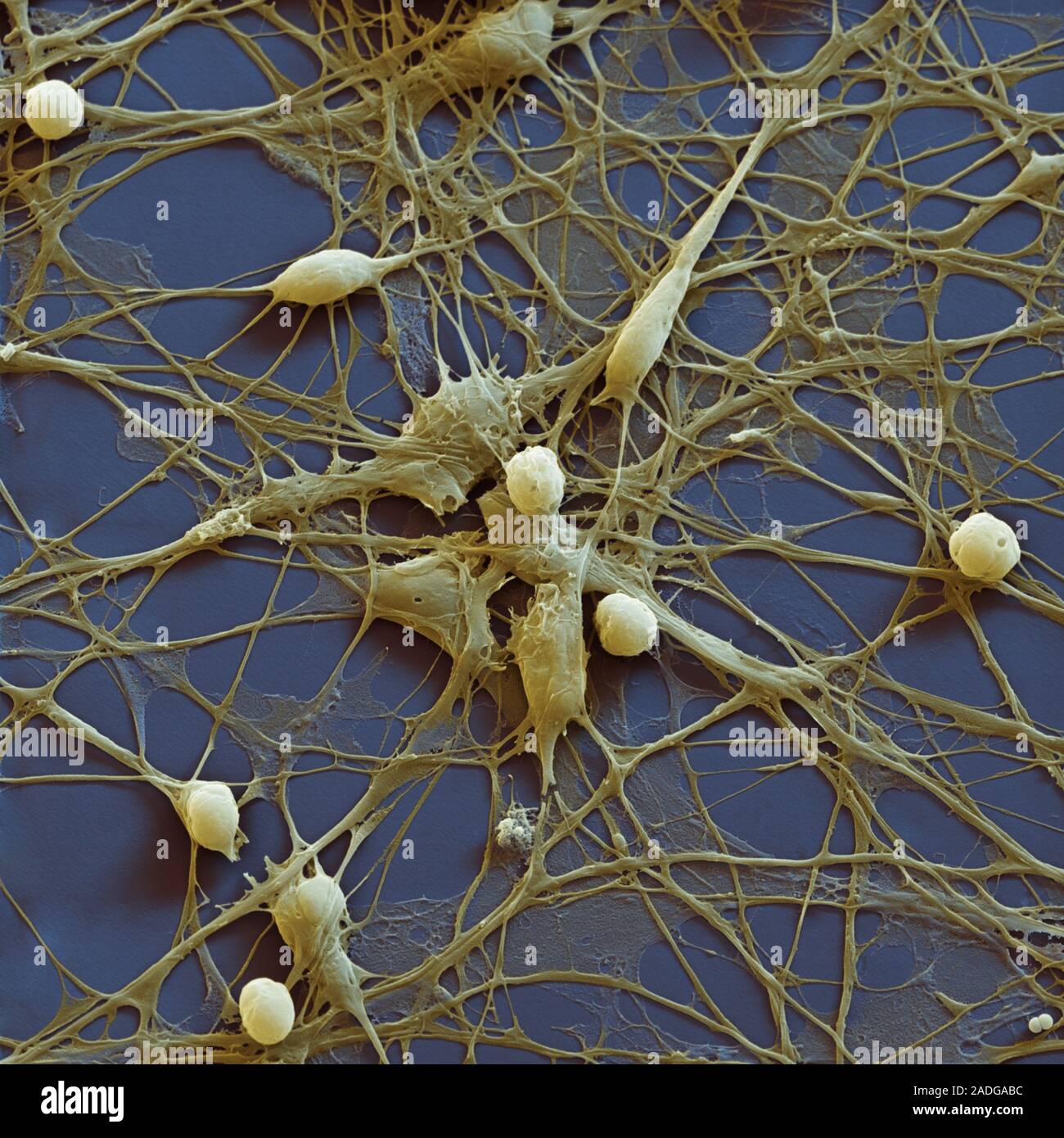 Human neural progenitor cells in a culture medium, coloured scanning ...