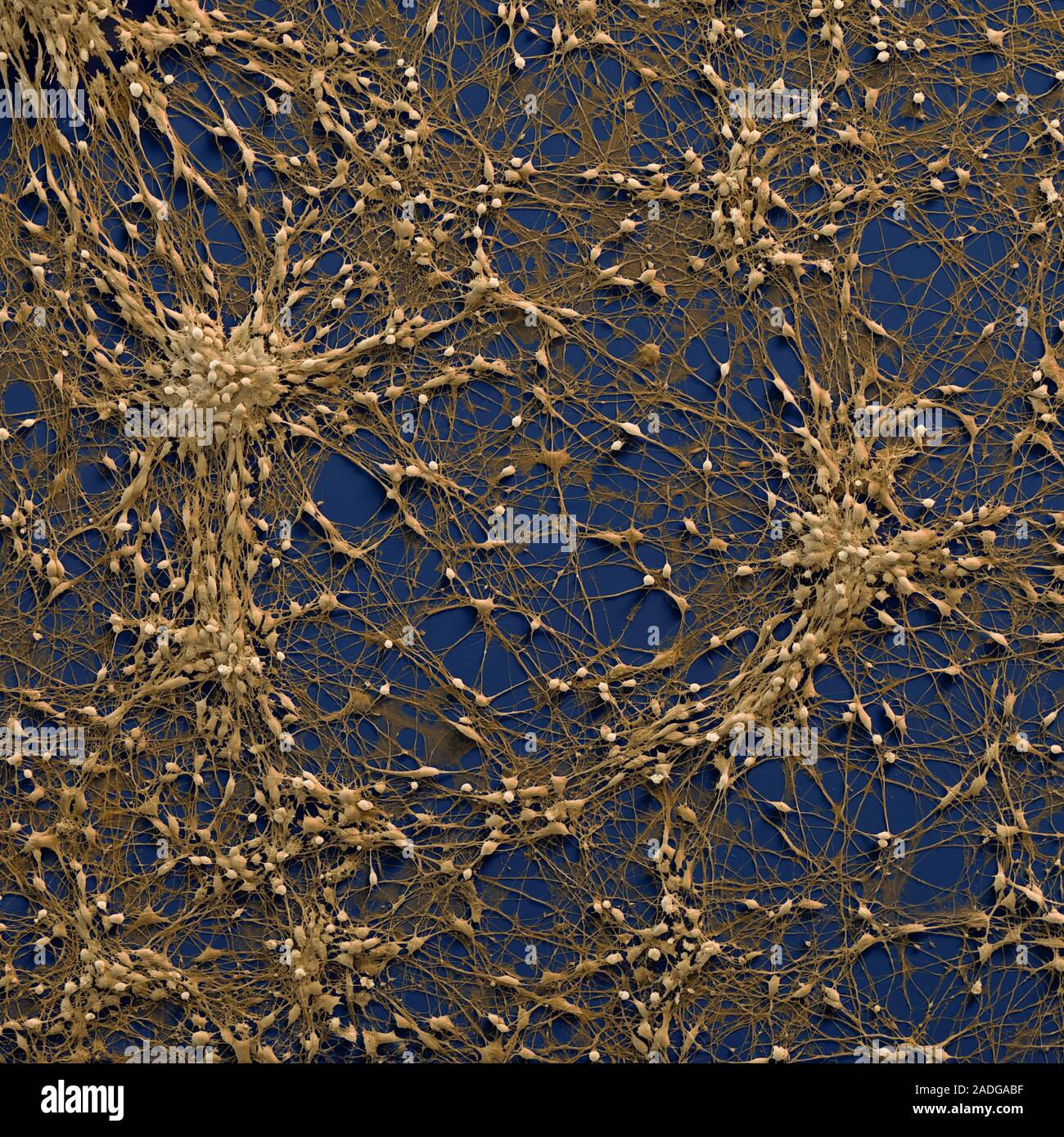 Human neural progenitor cells in a culture medium, coloured scanning ... Human neural progenitor cells in a culture medium, coloured scanning ...