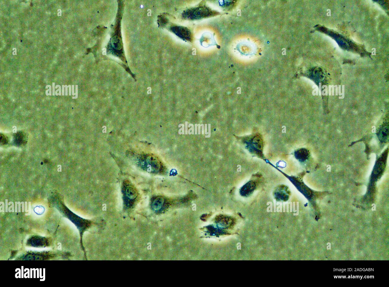 Endothelial stem cells. Light micrograph of stem cells that form the ...