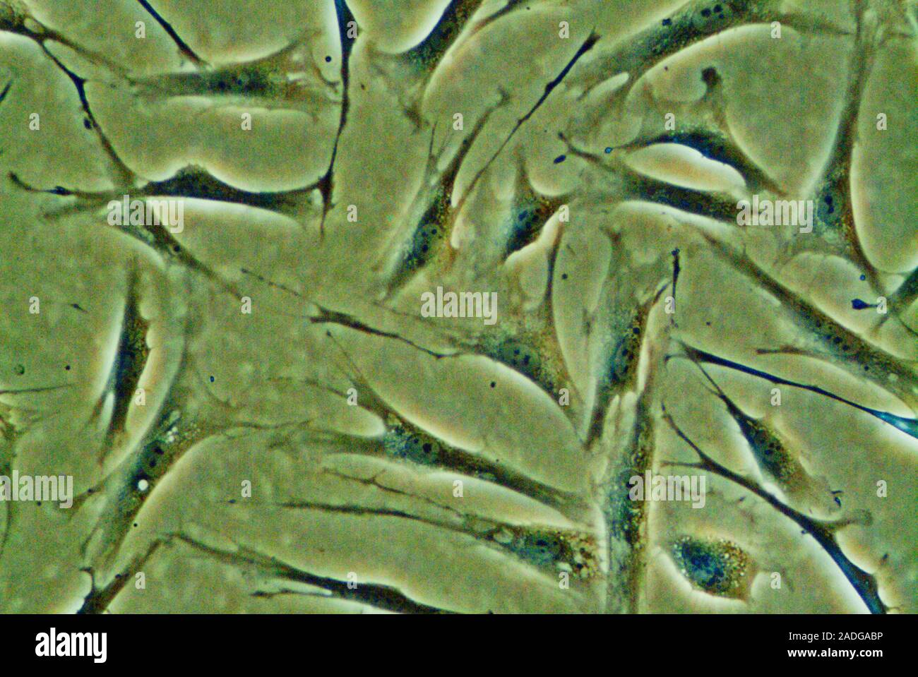 Fibroblast stem cells, light micrograph. Fibroblasts are cells that ...