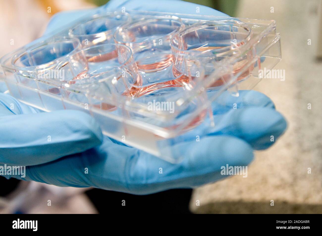 Cell cultures in multi-well sample trays being held in hands. The cells ...