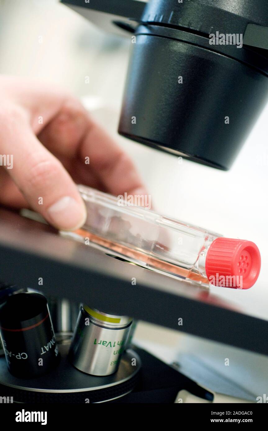 Cell culture in a sample tray being held under a microscope. The cells ...