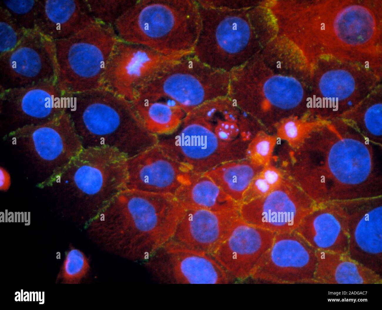 Apoptosis. Immunofluorescent Light Micrograph of a culture of normal ...