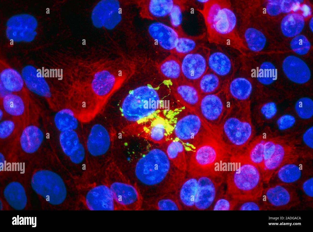 Apoptosis. Immunofluorescent Light Micrograph of a culture of normal ...